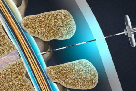 Pain Management Doctor in Staten Island & NJ | Dr. Nakul Mahajan